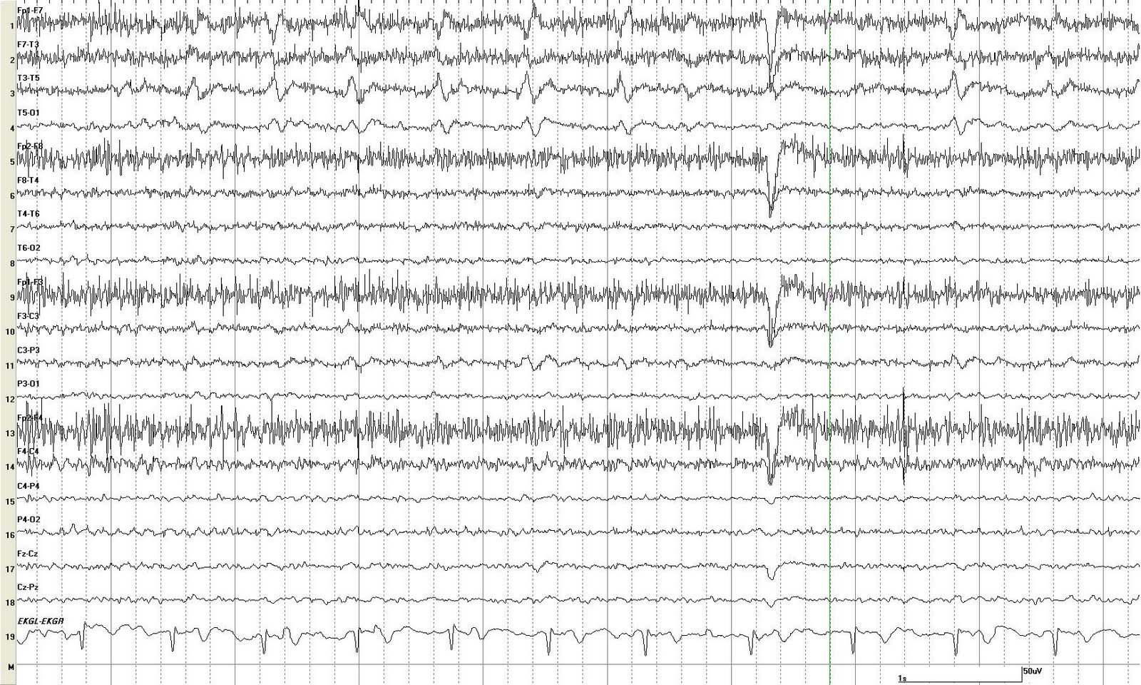 EEG Reviewer: EEG No. 27