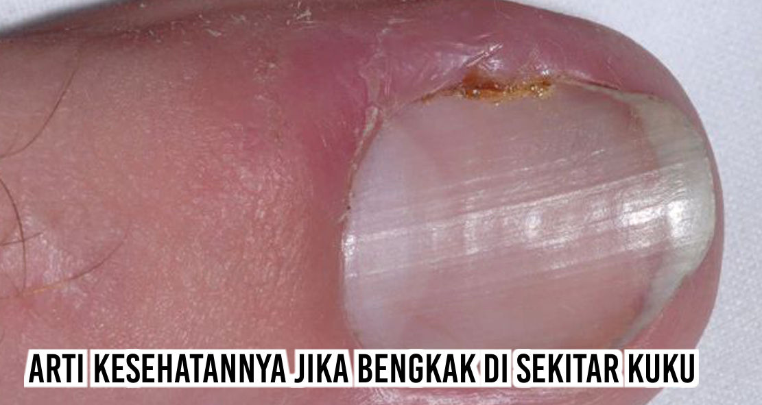 Ternyata, Bentuk Dan Warna Kuku Menunjukkan Kesehatanmu | zeropromosi | souvenir barang promosi ...