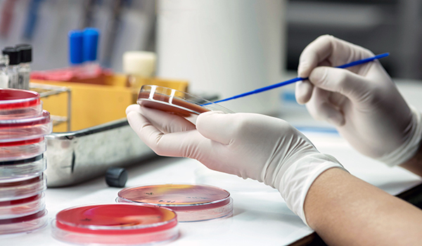 How to choose a reliable microbiological laboratory for antimicrobial ...