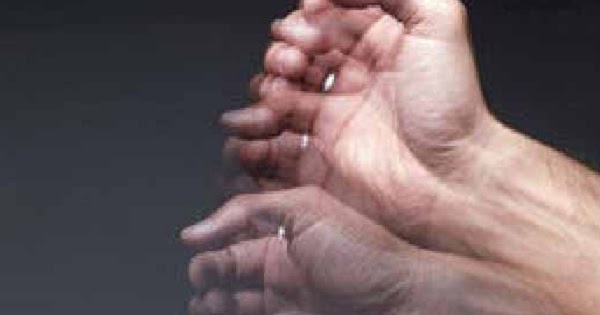 Hiperecplexia - Distúrbio Que Aciona Movimentos Exagerados - Saúde ...