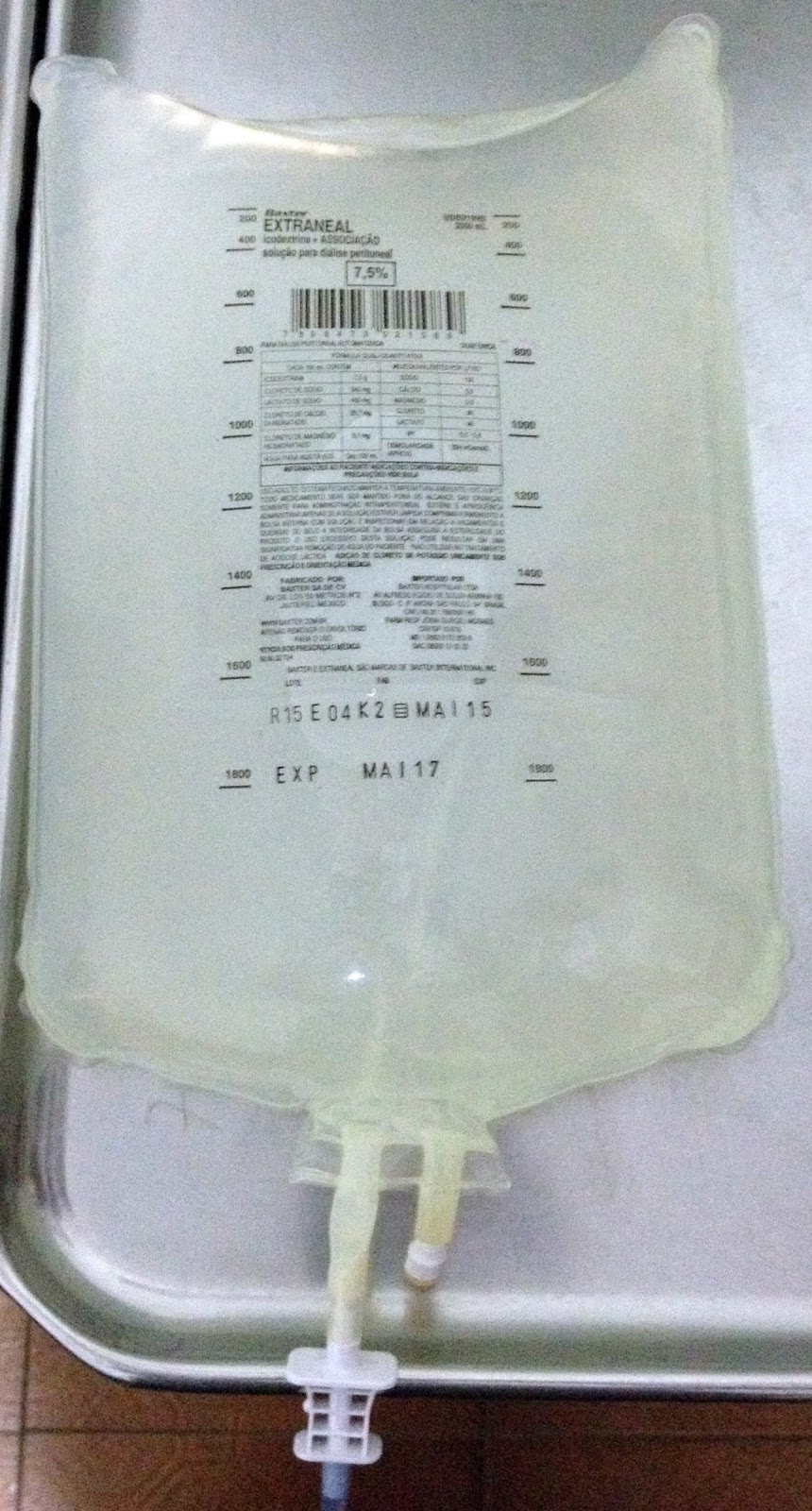 Diálise Peritoneal com icodextrina