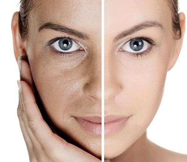 Todo lo que necesitas saber sobre la piel seca