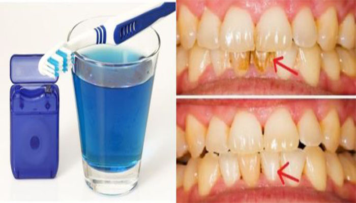 How To Remove Bacteria From Your Toothbrush And Save Your Teeth