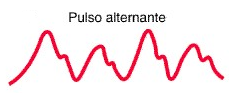 Detrás de la consulta: Semiología del Pulso Arterial.