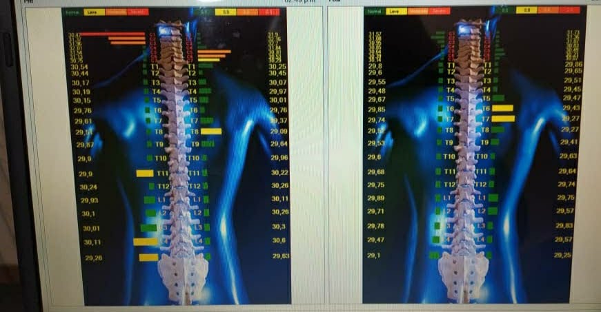 EL RINCONCITO SANADOR SPA, C.A.: Termografía de Columna Vertebral