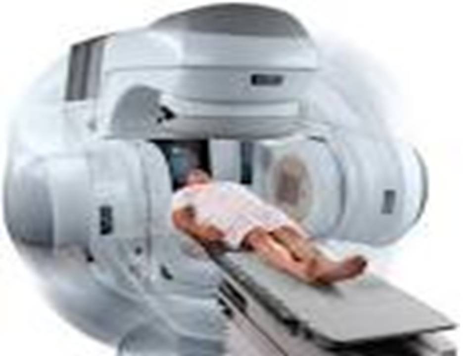 Cafe Radiologi: Peran Radioterapi Didalam Pengobatan Kanker Astrocytoma