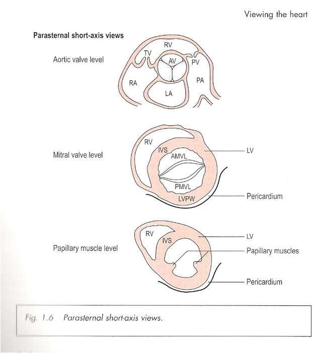 CVT Mohd Farid: Basic Echo Window :Parasternal Short Axis View