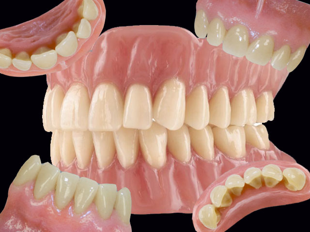 Prostodoncia Total – Roesch Ramos Laura