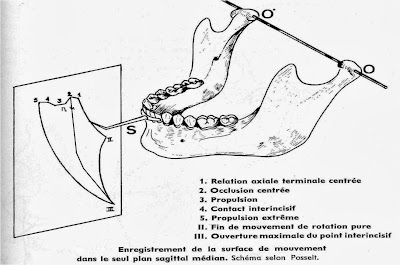 la prothèse dentaire: L’occlusion en prothèse adjointe partie1