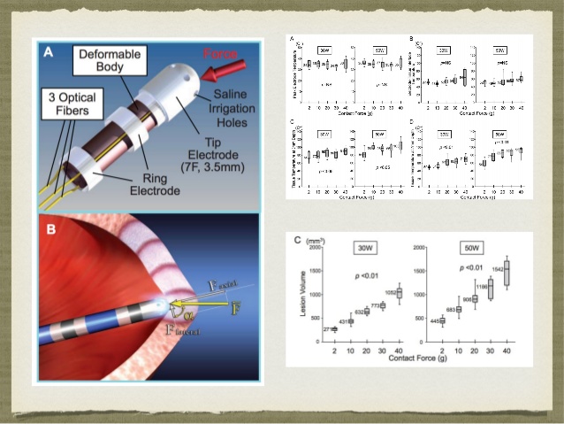 Dr Han Naung @ Henry Han : Electrophysiology and Heart Rhythm ...