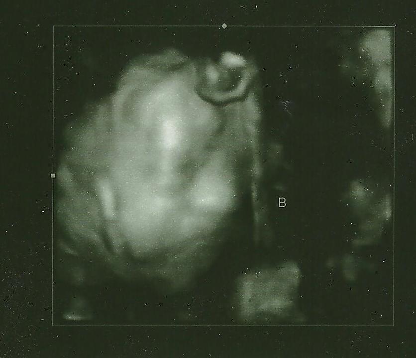 2 New Rubys: 31 Weeks: Growth Scan + MFM appt