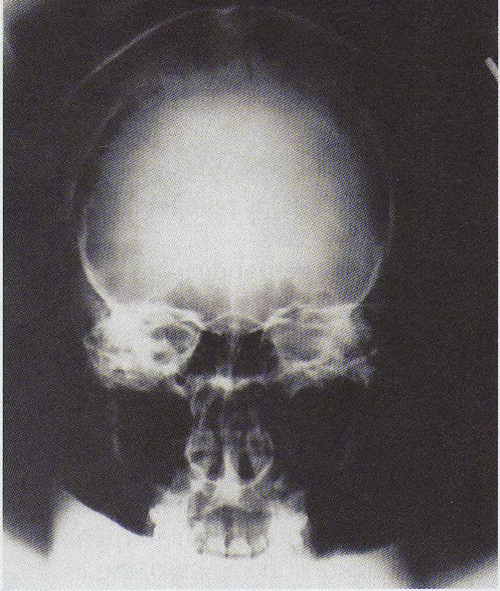 Sahabat Afterego: Prosedur Pemeriksaan Radiograf Cranium