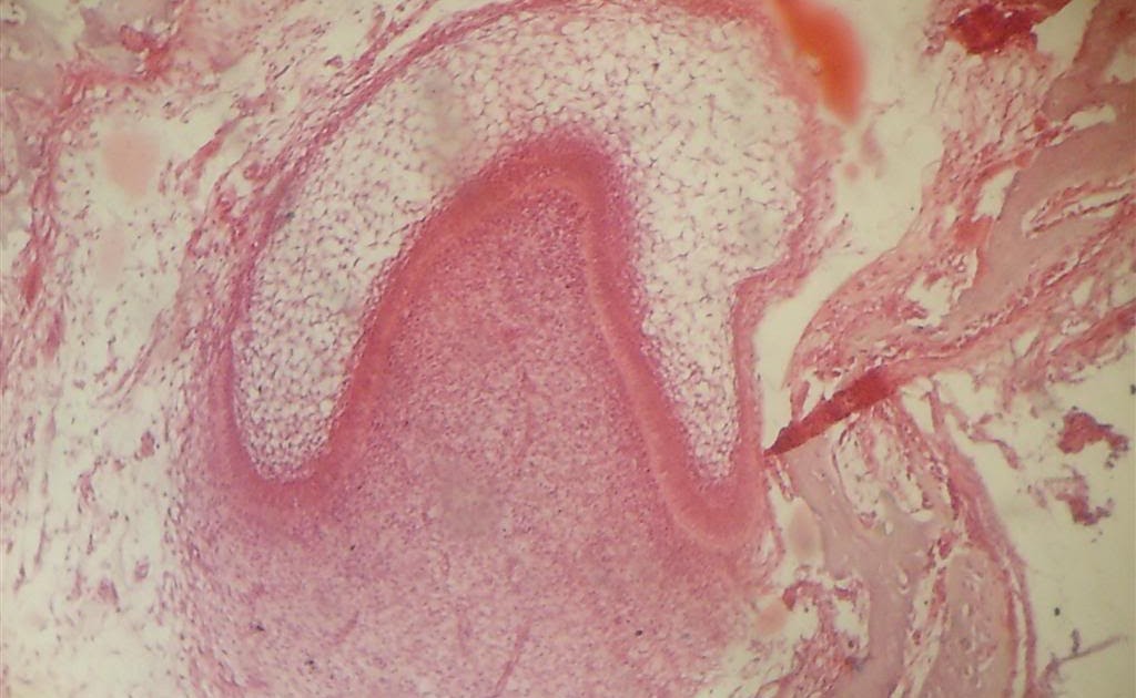 makemedicaleasy: Oral Histology, Embryology & Genetics Lecture notes ...