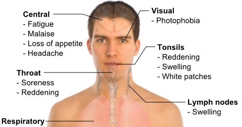 The Health Website : Glandular fever - Infectious Mononucleosis