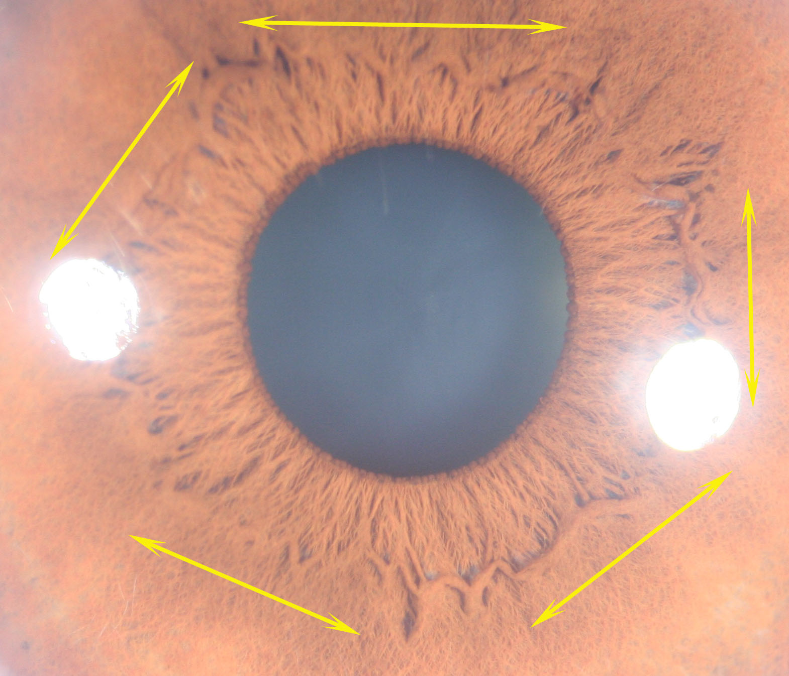 Modern & Multidimensional Iridology: The Internal & External Border of ...