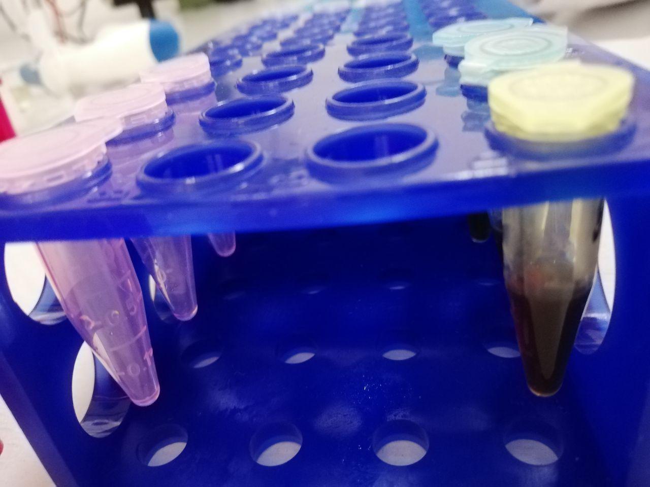 EXTRACCIÓN ADN GENÓMICO A PARTIR DE LOS LINFOCITOS DE LA SANGRE. (27 de ...