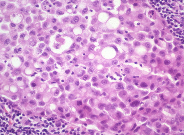 Extended Practice : Pink Ink || Pink cells || Image inspiration