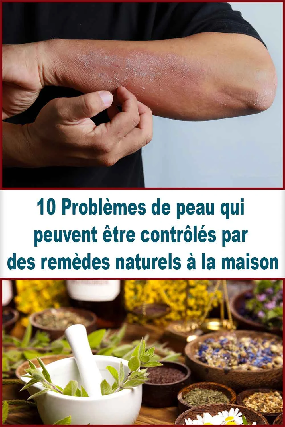 10 Problèmes de peau qui peuvent être contrôlés par des remèdes ...