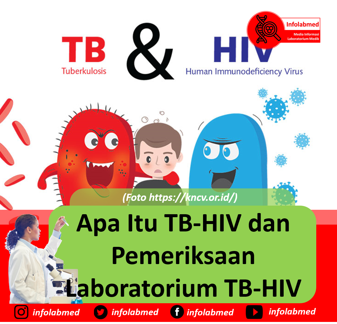Apa Itu TB-HIV dan Pemeriksaan Laboratorium TB-HIV
