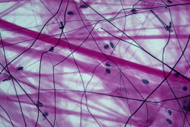 Pelajari Tentang Jaringan Ikat Tubuh - Sekolah007