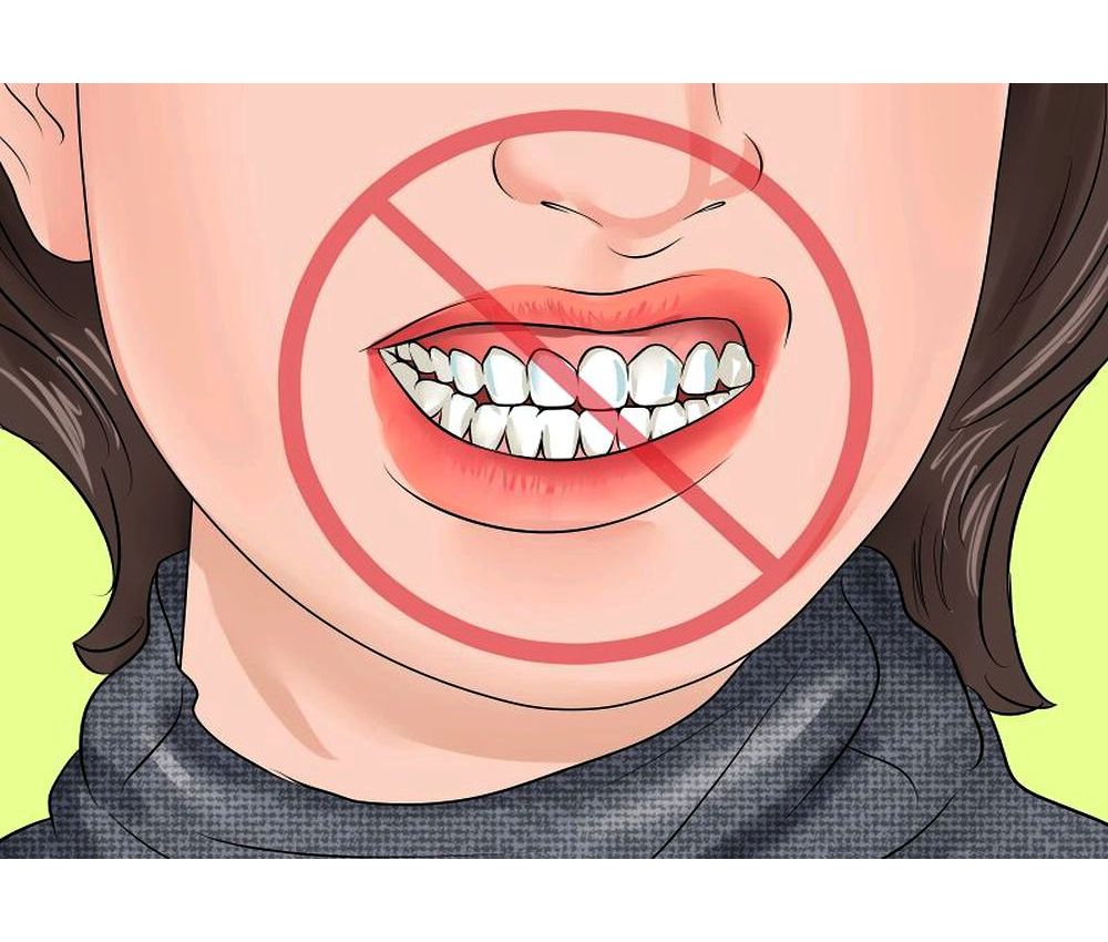 Nicotinic Stomatitis Icd 10