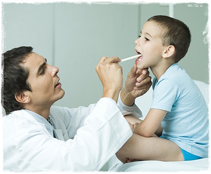 La faringoamigdalitis aguda en los niños | Con P de Pediatría