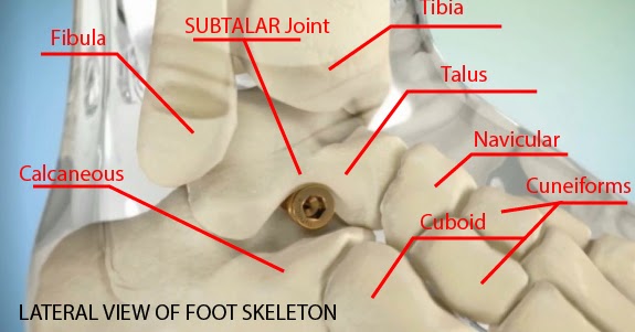 My Hyprocure Surgery and Recovery Blog