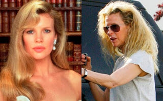 Kim Basinger Plastic Surgery Before and after Facelift and Nose Jobs ...
