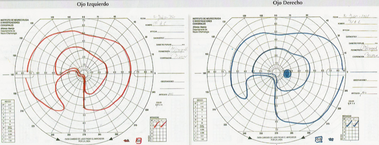 Cátedra N° 09 Campimetría y Perimetría