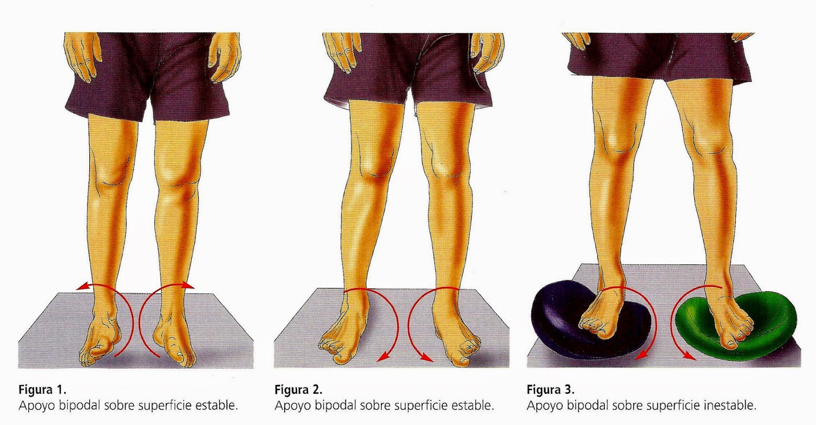 Saludea: Esguince de tobillo.