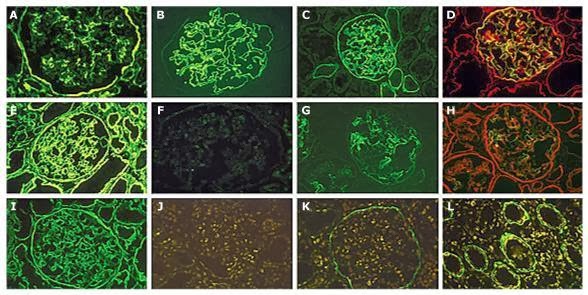 STUDY BIOLOGY: Síndrome de Alport