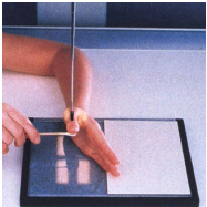 Study of the Thumb (First Digit) | Radiology
