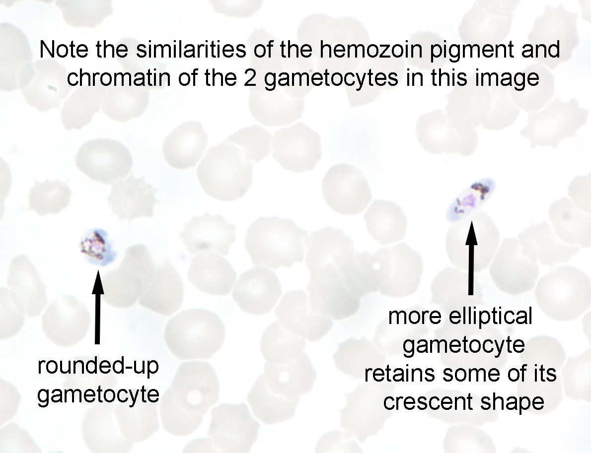 Creepy Dreadful Wonderful Parasites: Answer to Case 415