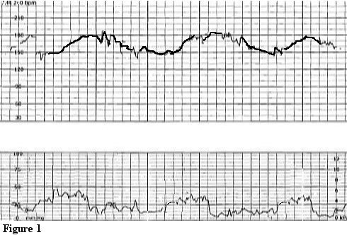 Fetal Heart Rate Monitoring