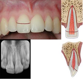 Dentistry lectures for MFDS/MJDF/NBDE/ORE: A Note On Definition ...