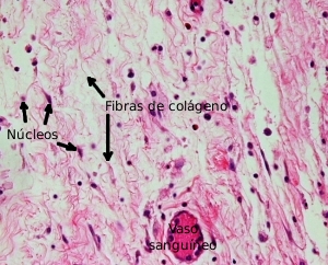 HISTO - EMBRIOLOGÍA : TEJIDO LAXO