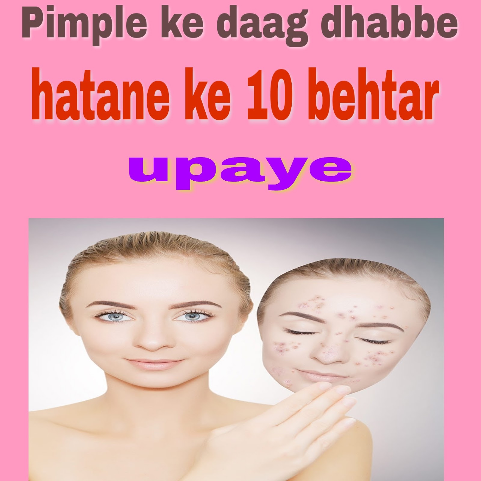 Health And beauty: Pimple ke daag dhabbe hatane ke 10 behtar upaye