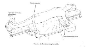 POSICION DE TRENDELENBURG INVERTIDO