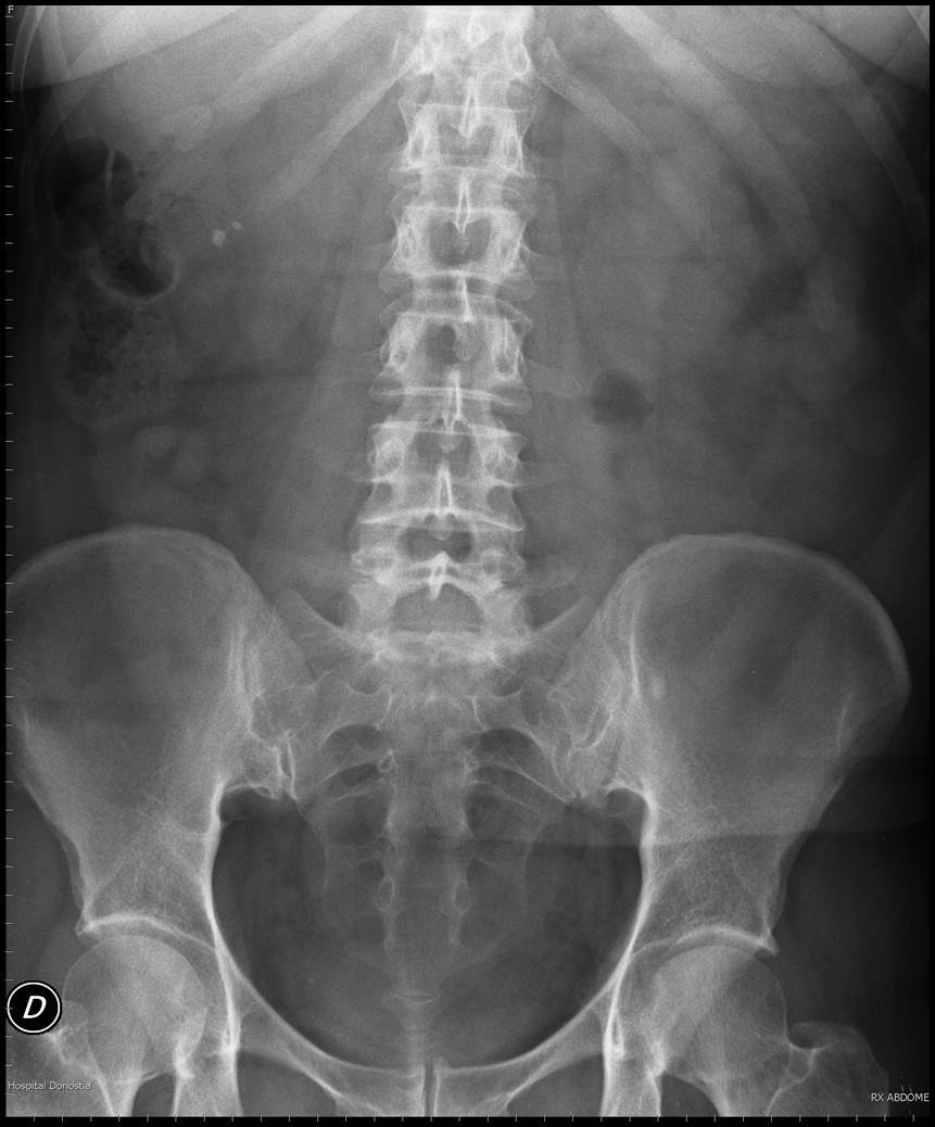 RADIOLOGIA ABDOMINAL: RADIOLOGÍA ABDOMINAL