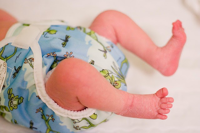 Dermapixel: junio 2013