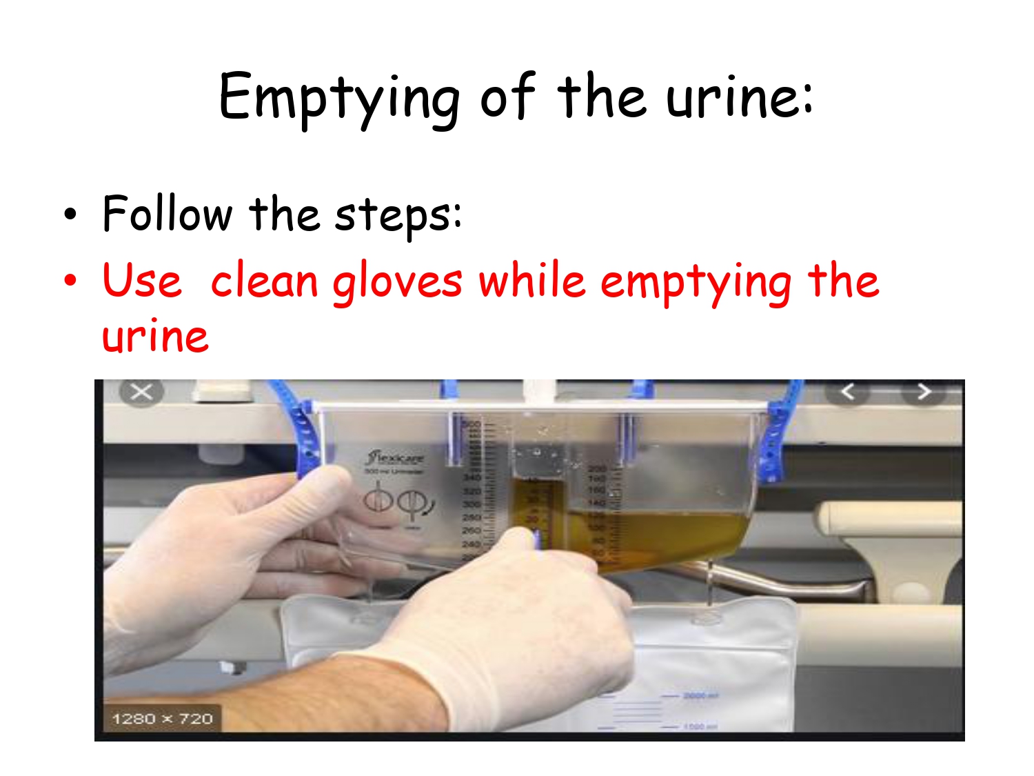 Importance of Infection Prevention from CAUTI and Use of Care Bundle ...