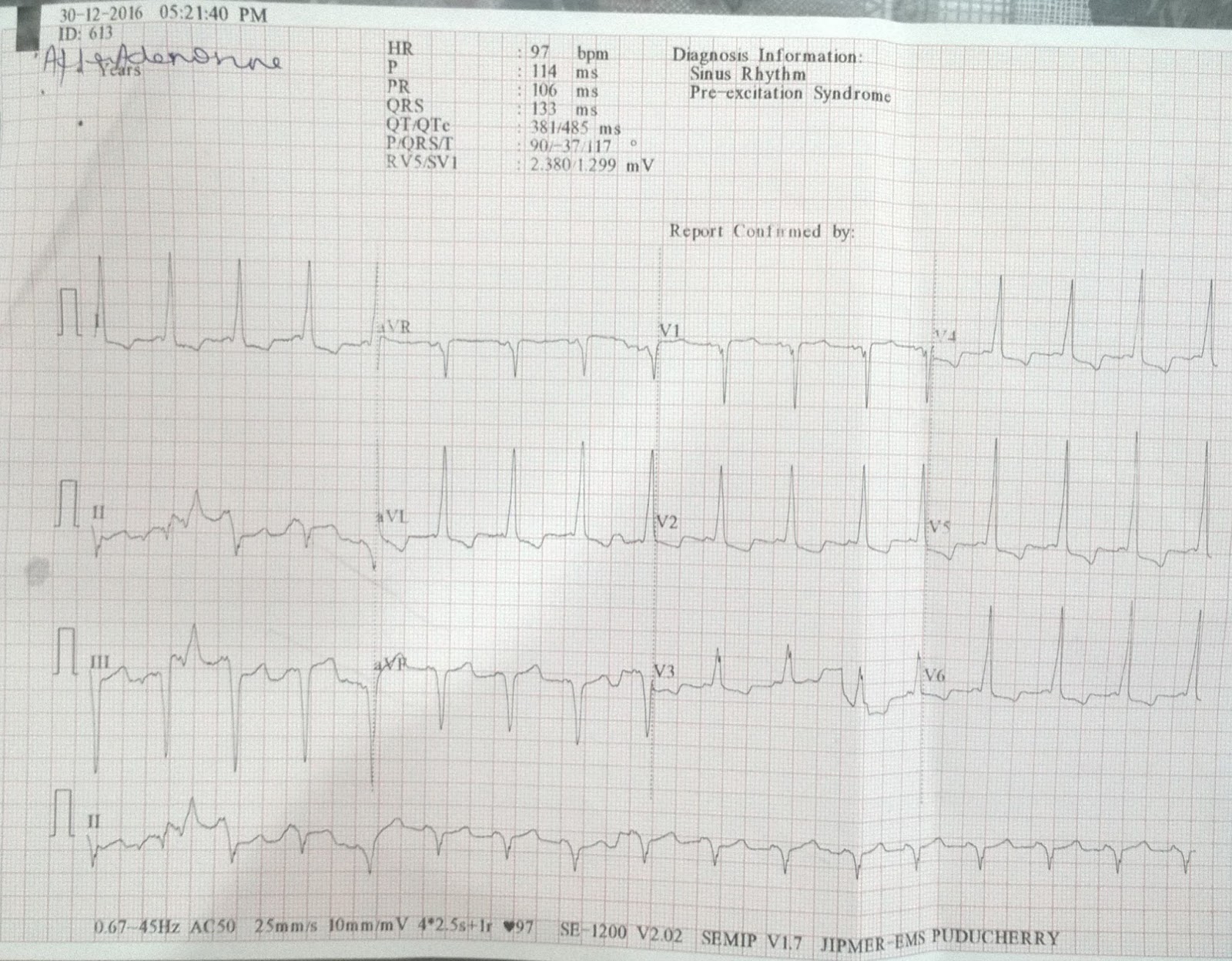 Cardiology window: ECG WPW syndrome