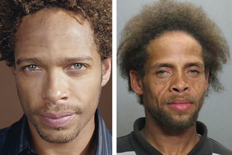 Shocking Photos of Celebrities Before and After Drugs - NEWSOLOGYS