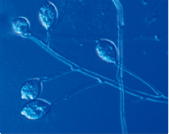 Traveling Small with a Nucleus: Phytophthora infestans