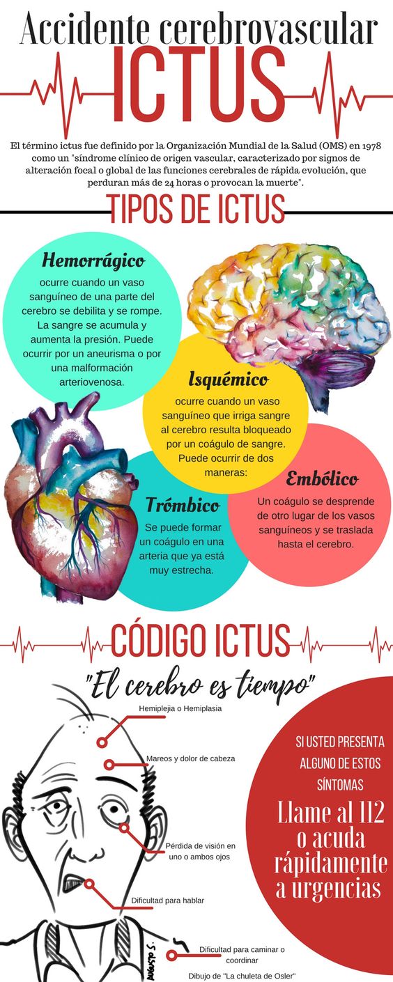 De Todo un Poco: Día del Ictus