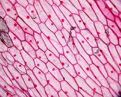 Irene's Research and Study: PENGAMATAN SEL TUMBUHAN & PLASMOLISIS
