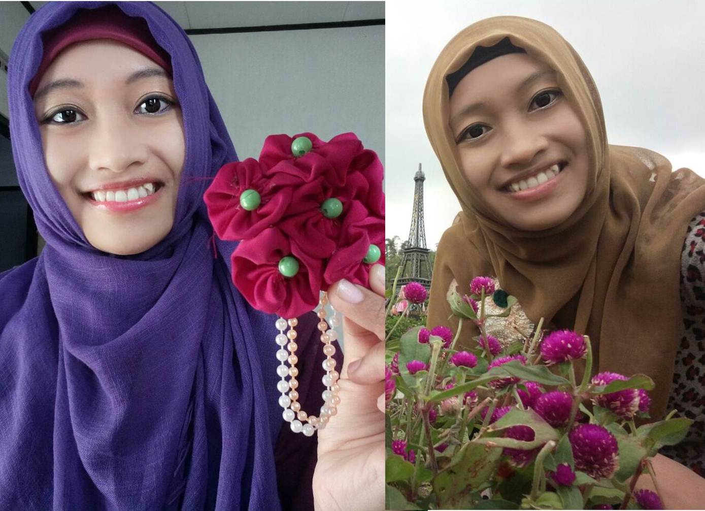 Tampil Percaya Diri Dengan Gigi Gingsul - Nisa's Wonderful Life Story