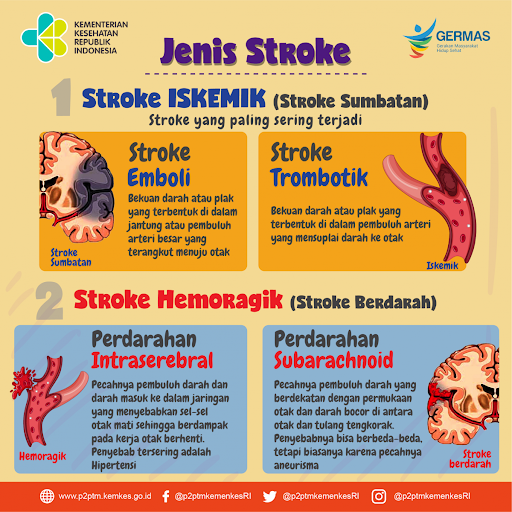 Pengertian dan Klasifikasi Stroke - lifestyle daily