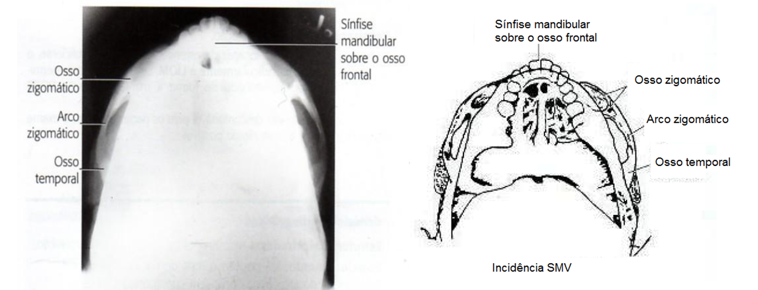 Laboratório de Roentgen: Crânio e Face