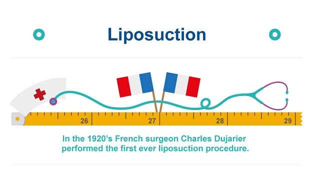 Liposuction - Facts and Figures #infographic - Visualistan